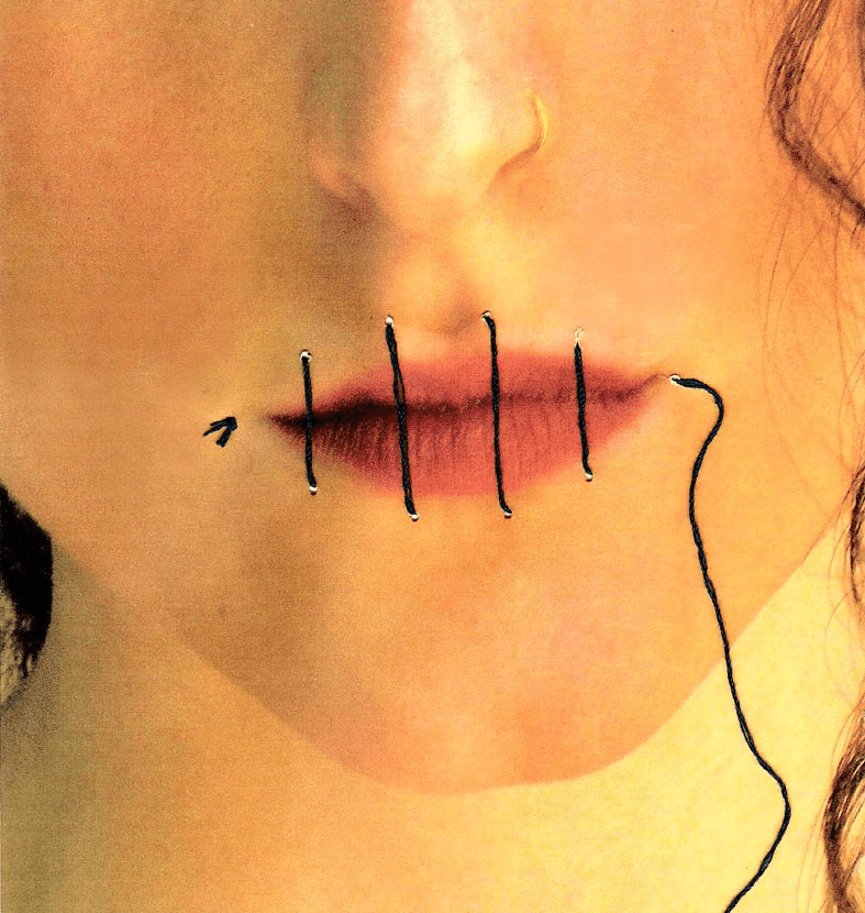 El Abuso de Poder de la Mayoría PNP en la Legislatura Municipal de San Juan